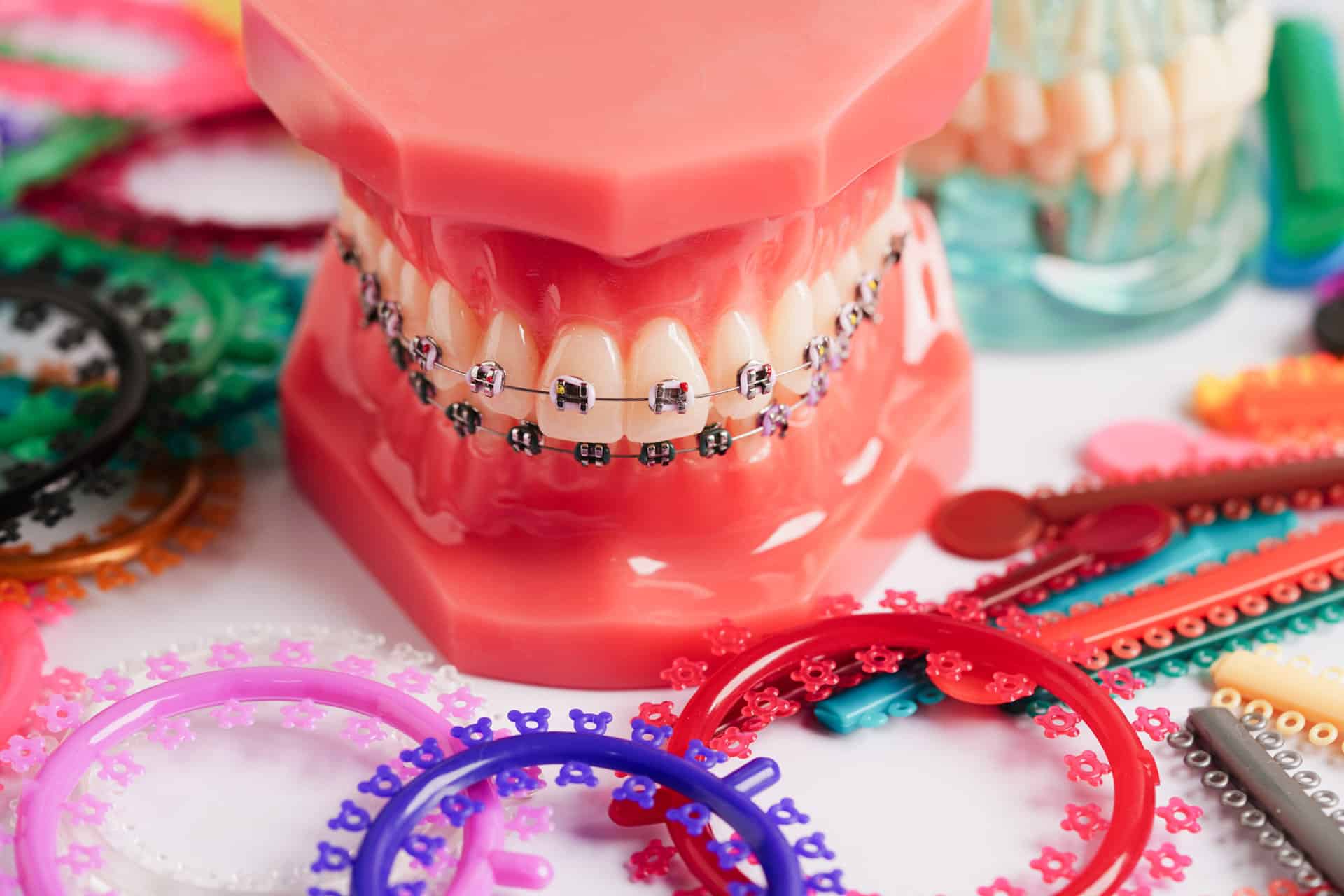 Orthodontic Info | Treasure Valley Orthodontist Office